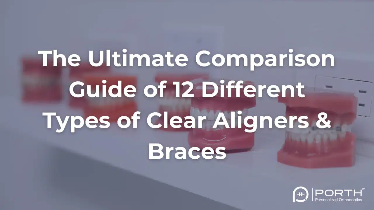 The Ultimate Guide of 12 Different Types of Braces and Clear Aligners
