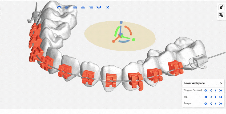 LightForce Braces: Benefits, Myths, Cost & Alternatives